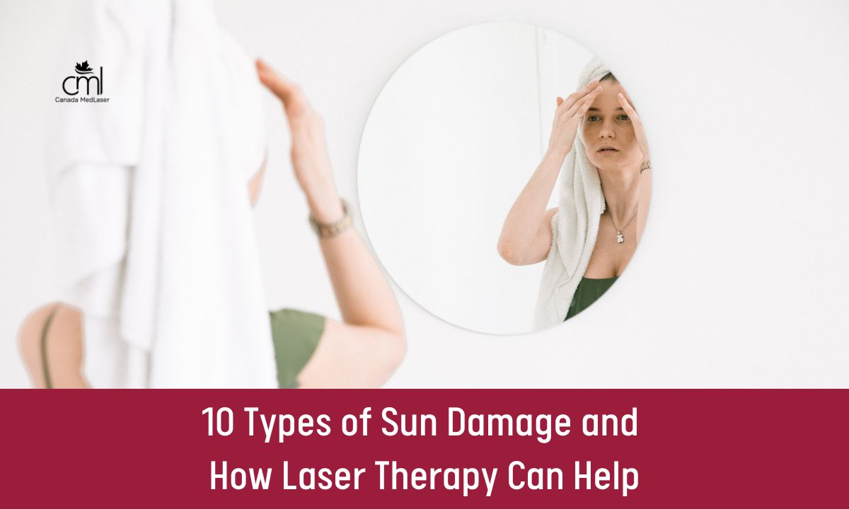 10 Types of Sun Damage and How Laser Therapy Can Help | Canada MedLaser